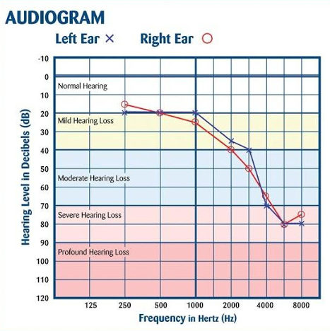 Adult Hearing Test | Sydney Hearing Clinic